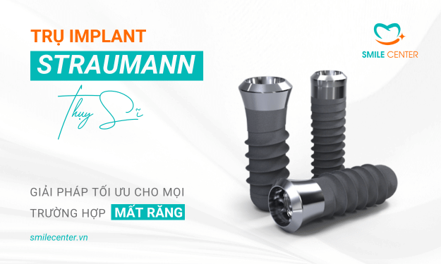 Top 9+Trụ răng implant chất lượng và an toàn khi cấy ghép implant ...