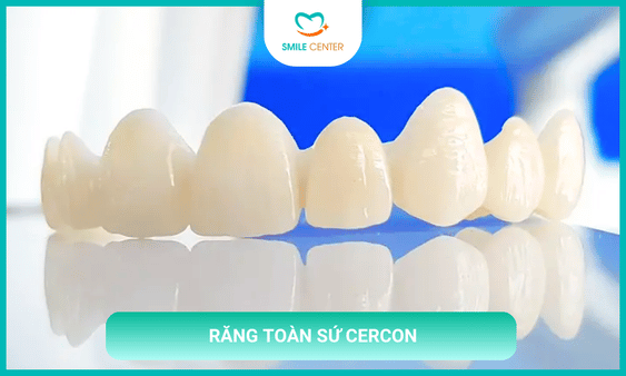 Răng toàn sứ Cercon: Công Nghệ Cao Cho Nụ Cười Rạng Rỡ - smilecenter